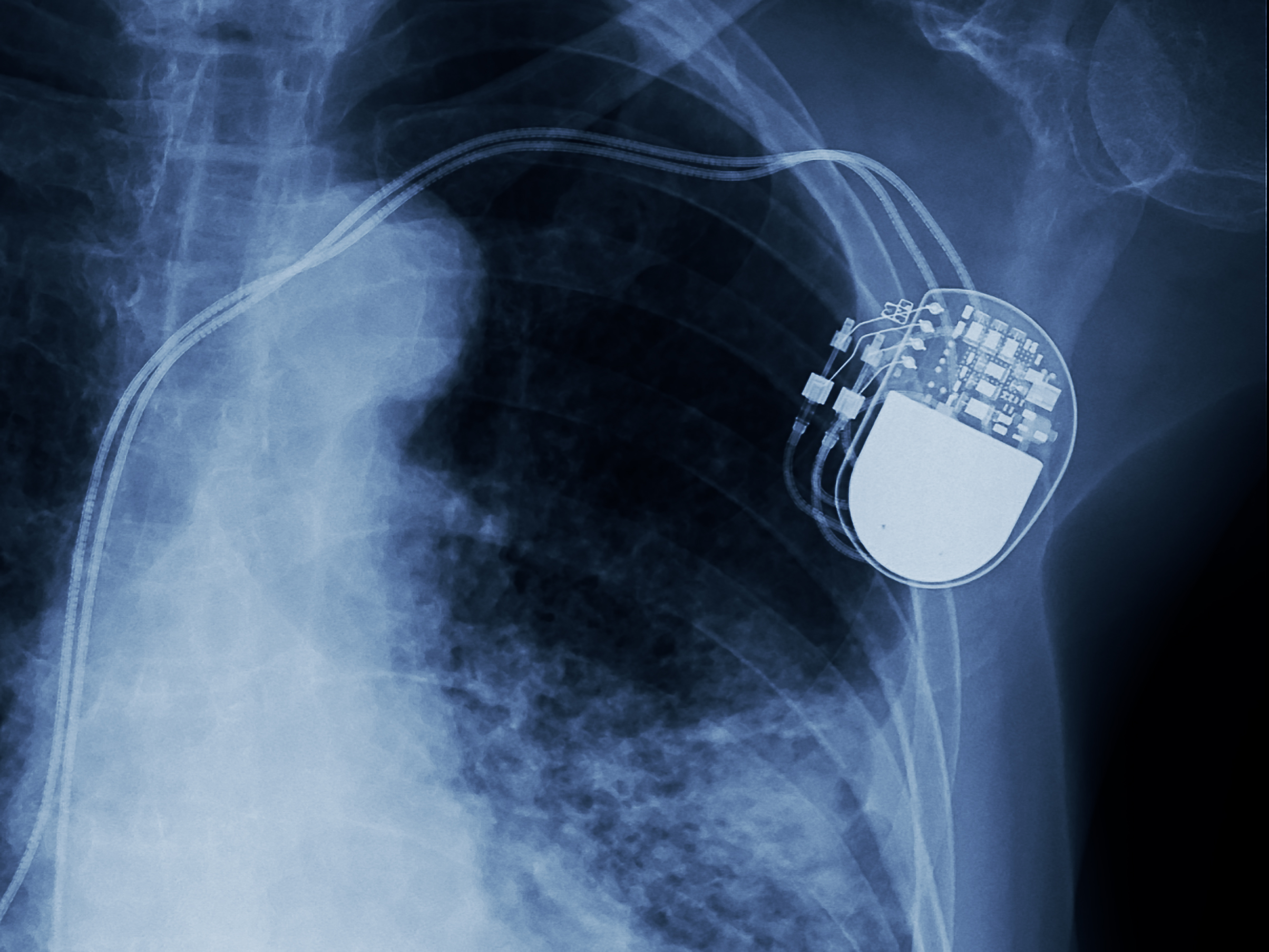 Biocompatible Magnets - BJA Magnetics